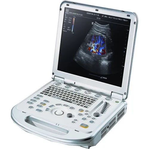 Mindray M7 Portable Ultrasound - Indoelectronic