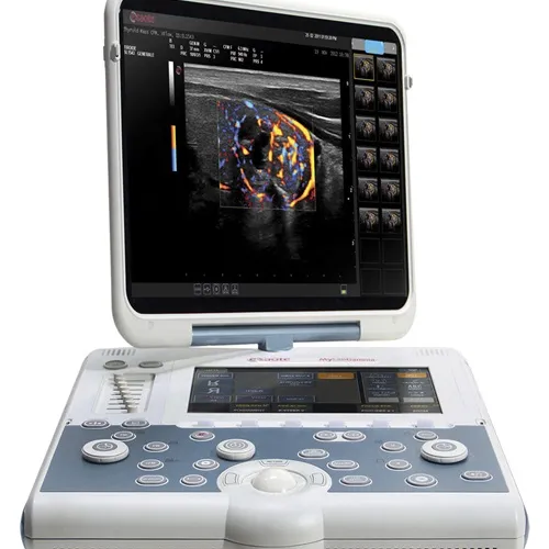 Esaote Mylab Gamma Multipurpose Portable Ultrasound - Indoelectronic