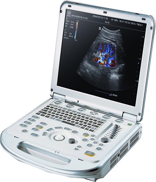 Mindray M7 Portable Ultrasound - Indoelectronic